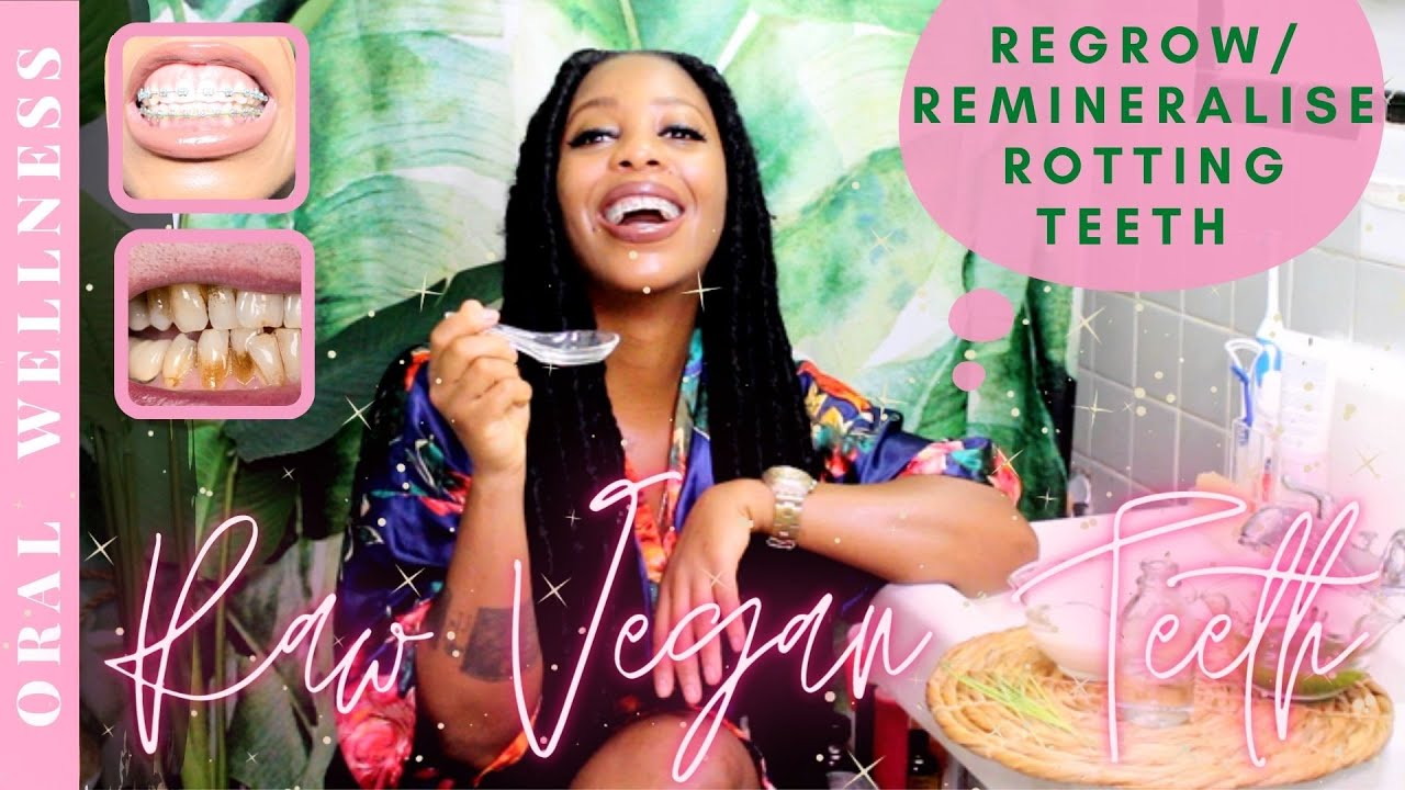 Vegan Tooth Decay | How I Remineralize and Reverse Tooth Decay ...