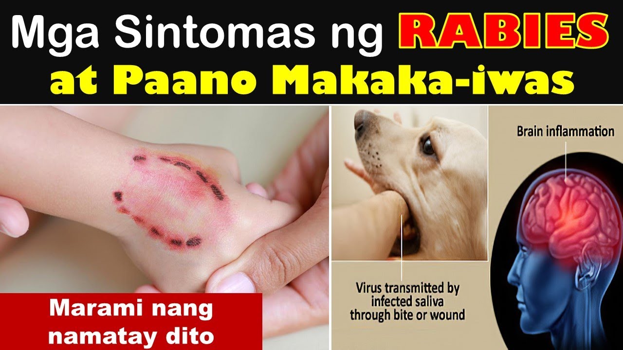 Mga sintomas ng Rabies at mga paraan para maka iwas dito - YouTube