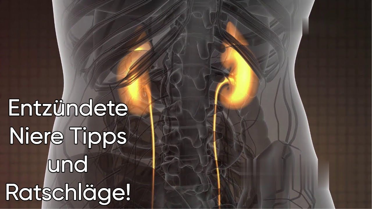 Entzündete Niere Tipps und Ratschläge! #Niere #Entzündete #Symptome # ...