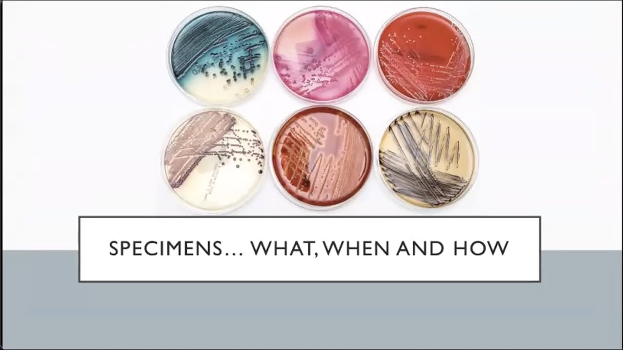 What specimen, when and how? - YouTube