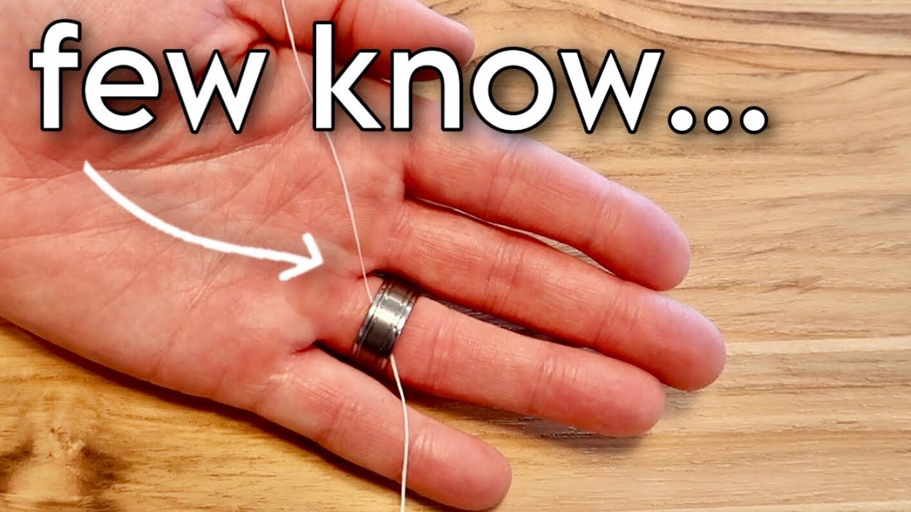 A doctor showed me how to remove the ring that was stuck on my finger 🔥 ...