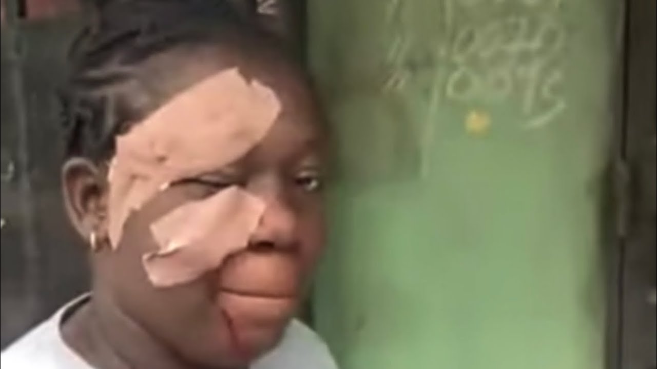 Breaking: Peter Obi Bravely Visits Jennifer Efidi, The Lagos Woman ...