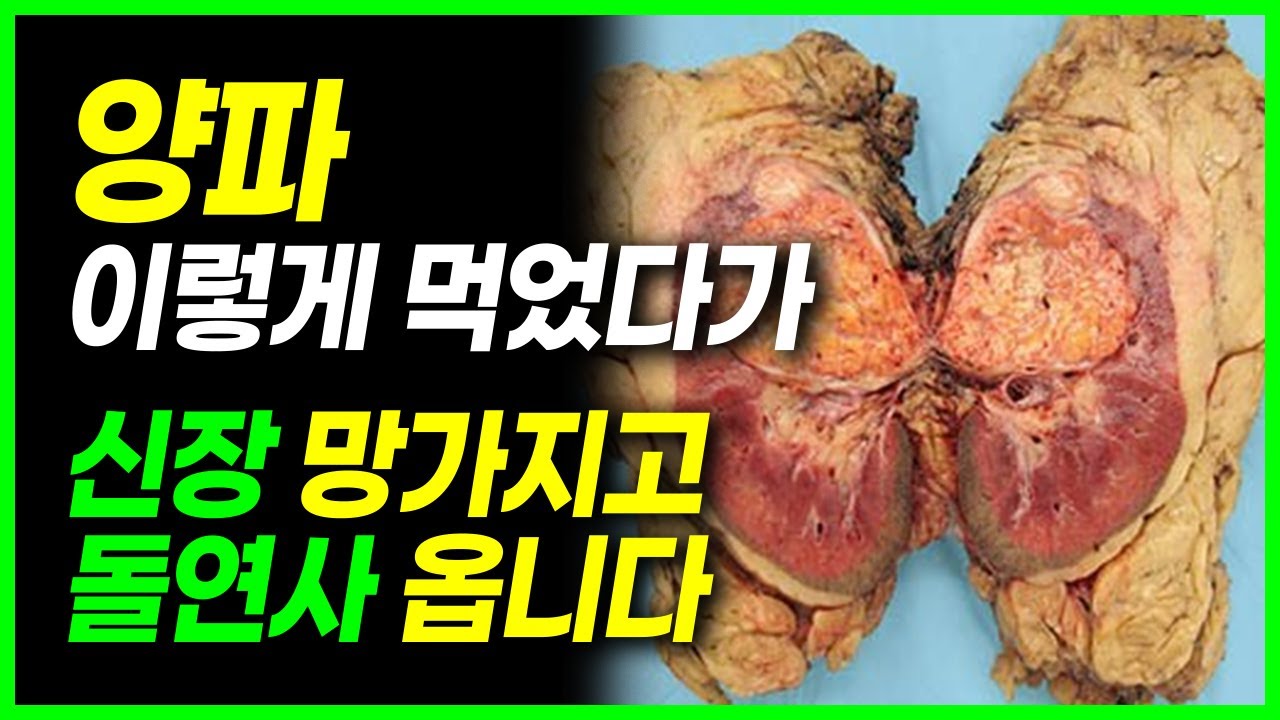 양파 이렇게 먹었다가 돌연사 할수 있어요 양파100배로 효과있게 먹는법 심혈관질환 콜레스테롤 당뇨 신장 콩팥 염증