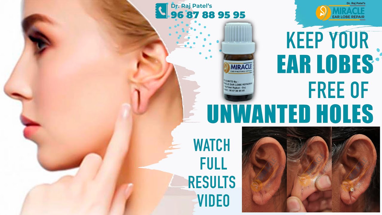 Ear Lobe Repair / Ear Holl Repair / Torn Ear Repair / Ear Pasting ...
