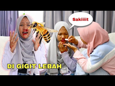 GAWAT !! HIDUNG AYA BERD4R4H KENA LEBAH l CHIKAKU CHANNEL