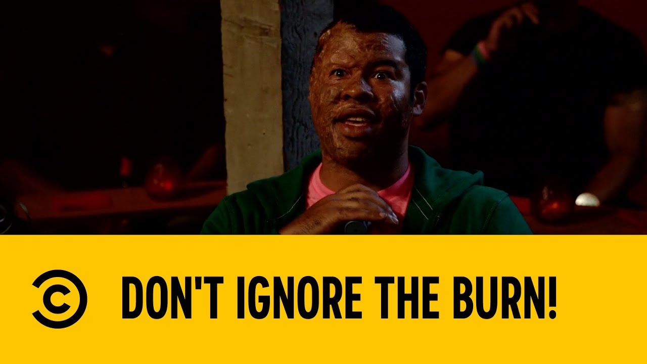 Don't Ignore The Burn! | Key & Peele | Comedy Central Africa - YouTube