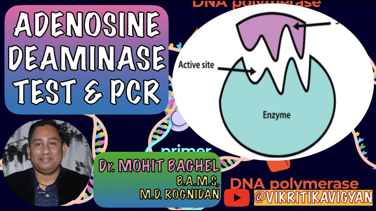 ADENOSINE DEAMINASE TEST & PCR TEST FOR TUBERCULOSIS BY Dr. Mohit ...