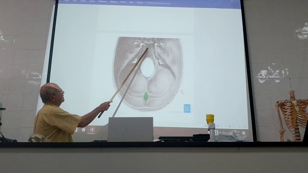 Anatomy of head & neck 14 ( Skull , part 14 , norma basalis interna ...