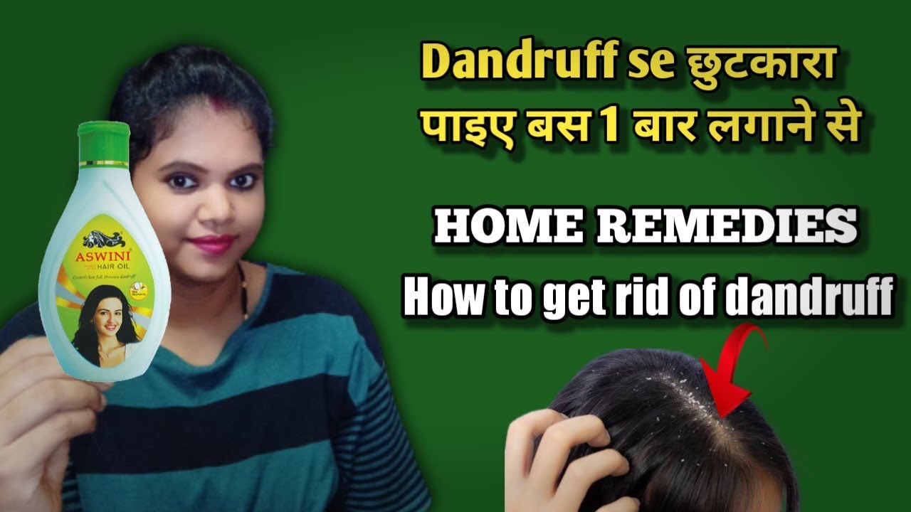 How To Remove Dandruff - Home Remedy That Works Fast! - YouTube