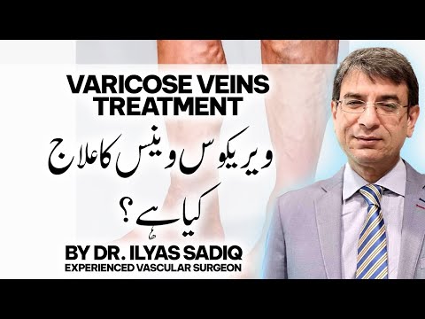 Varicose Veins Treatment! Symptoms & Causes Explained By | Dr. Ilyas Sadiq Vascular Surgeon
