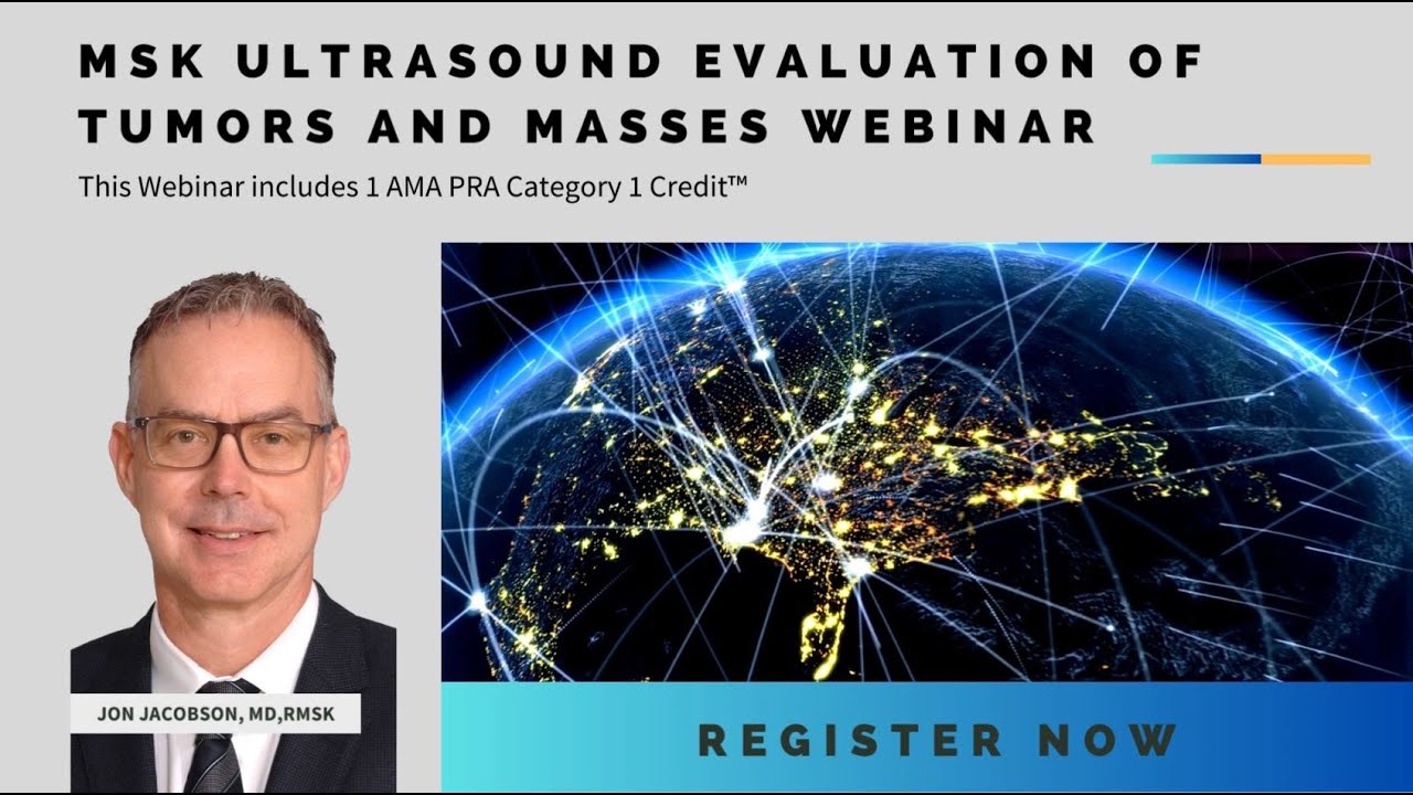 MSK Ultrasound Evaluation of Tumors and Masses Webinar PROMO - YouTube