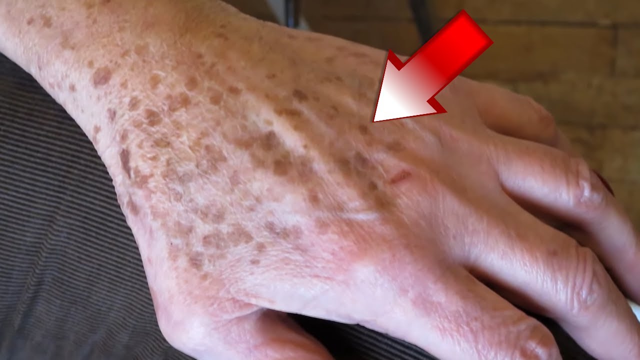 👉Receta Para Ayudar a Borrar Las Arrugas y Manchas De Las Manos - YouTube