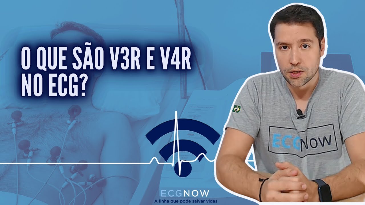 O que são V3R e V4R no ecg? - YouTube