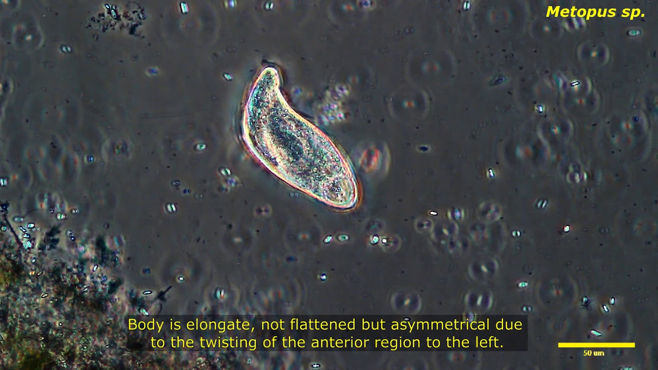 Metopus - Description - Protozoans and other small critters - YouTube