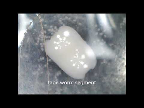 Tapeworm segment and eggs - YouTube
