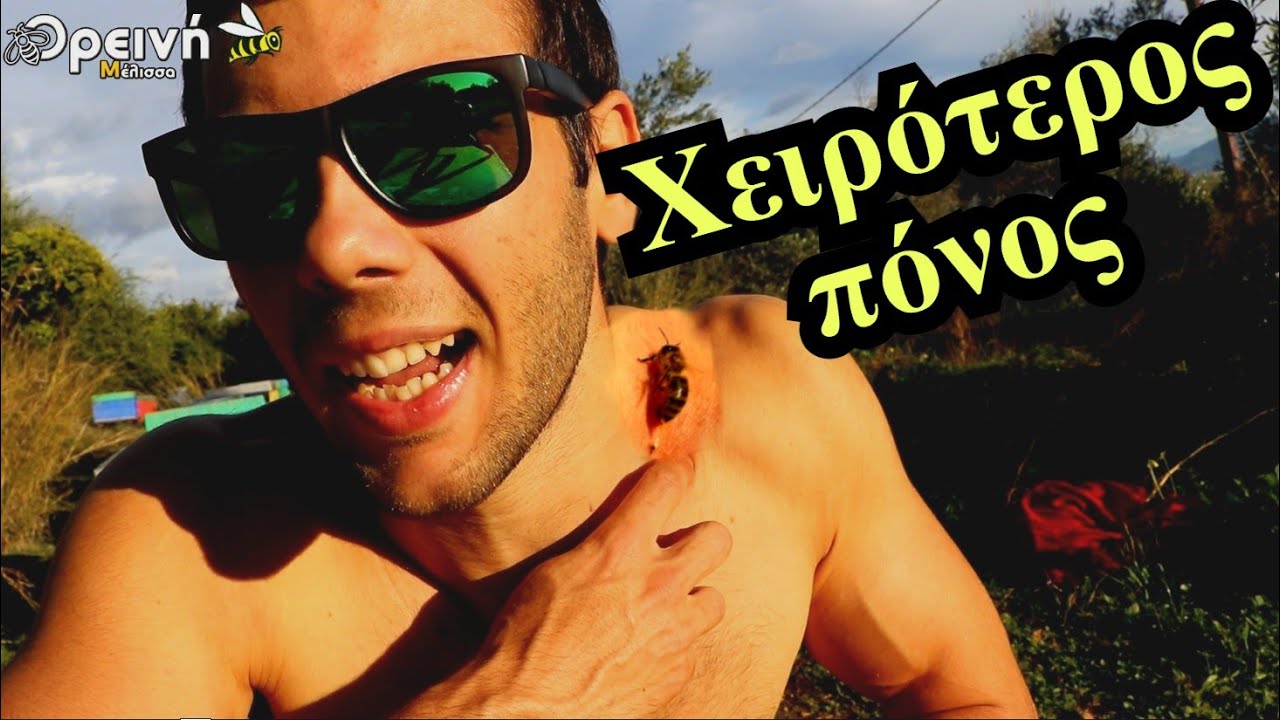 Ο χειρότερος ΠΟΝΟΣ απο τσιμπίματα ΜΕΛΙΣΣΩΝ - YouTube
