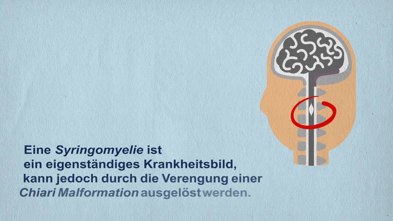 Deutsche Syringomyelie und Chiari Malformation e.V. - YouTube