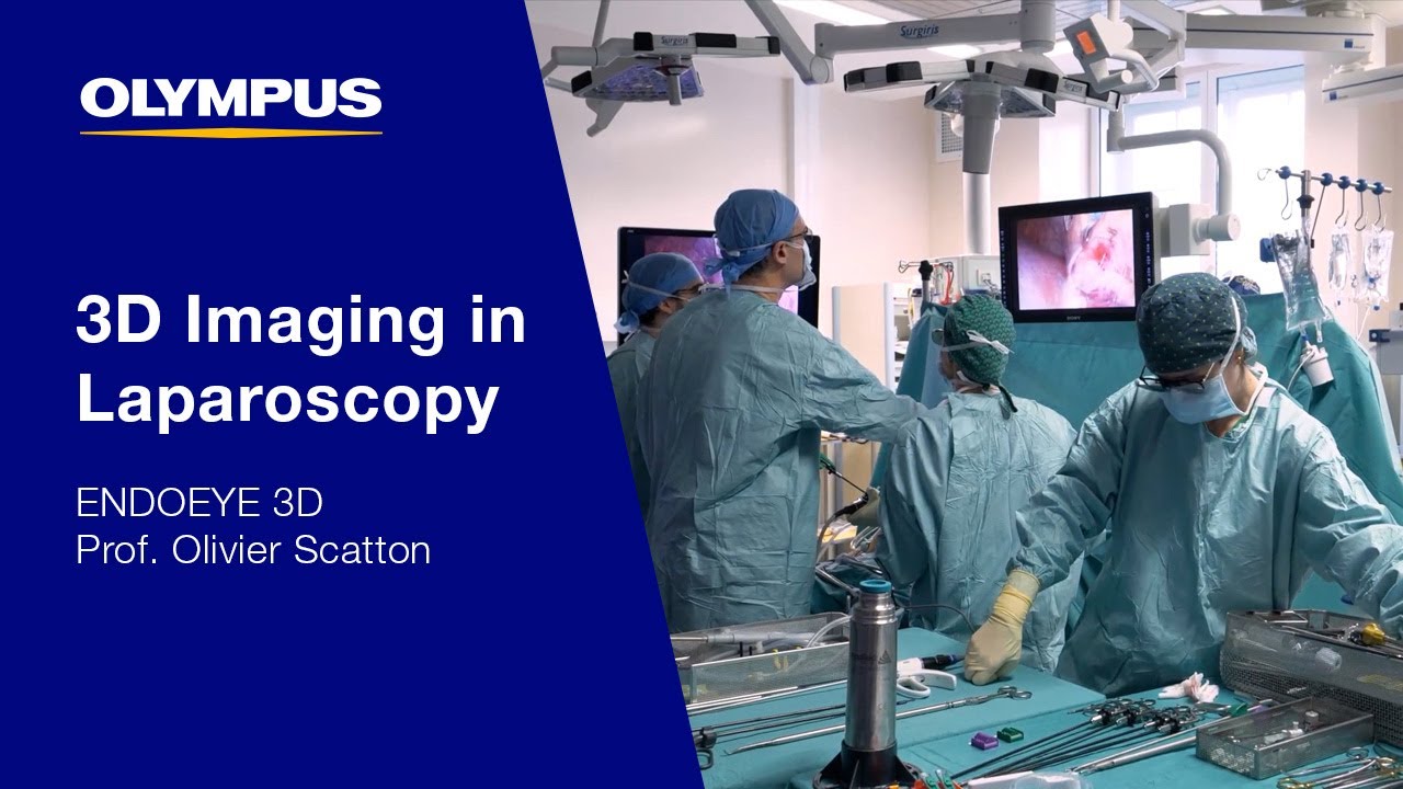 3D Imaging in Laparoscopy | ENDOEYE 3D | Prof. Olivier Scatton - YouTube
