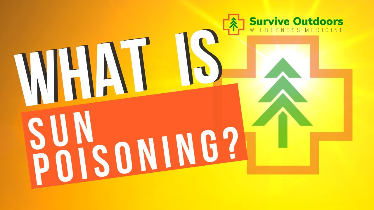 Sun Poisoning: What Is, Risk Factors, Symptoms, Diagnosis, and Treatment