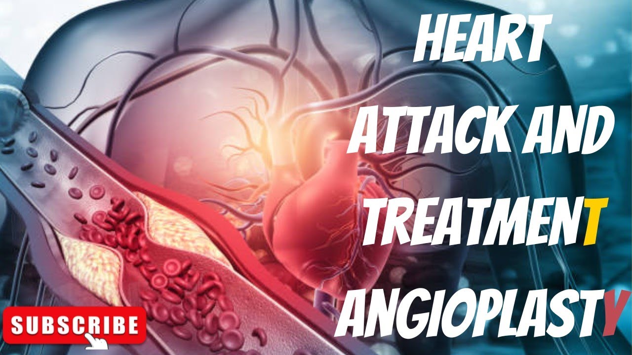 What Happens During A Heart Attack? | Recognise A Heart Attack | 3D ...