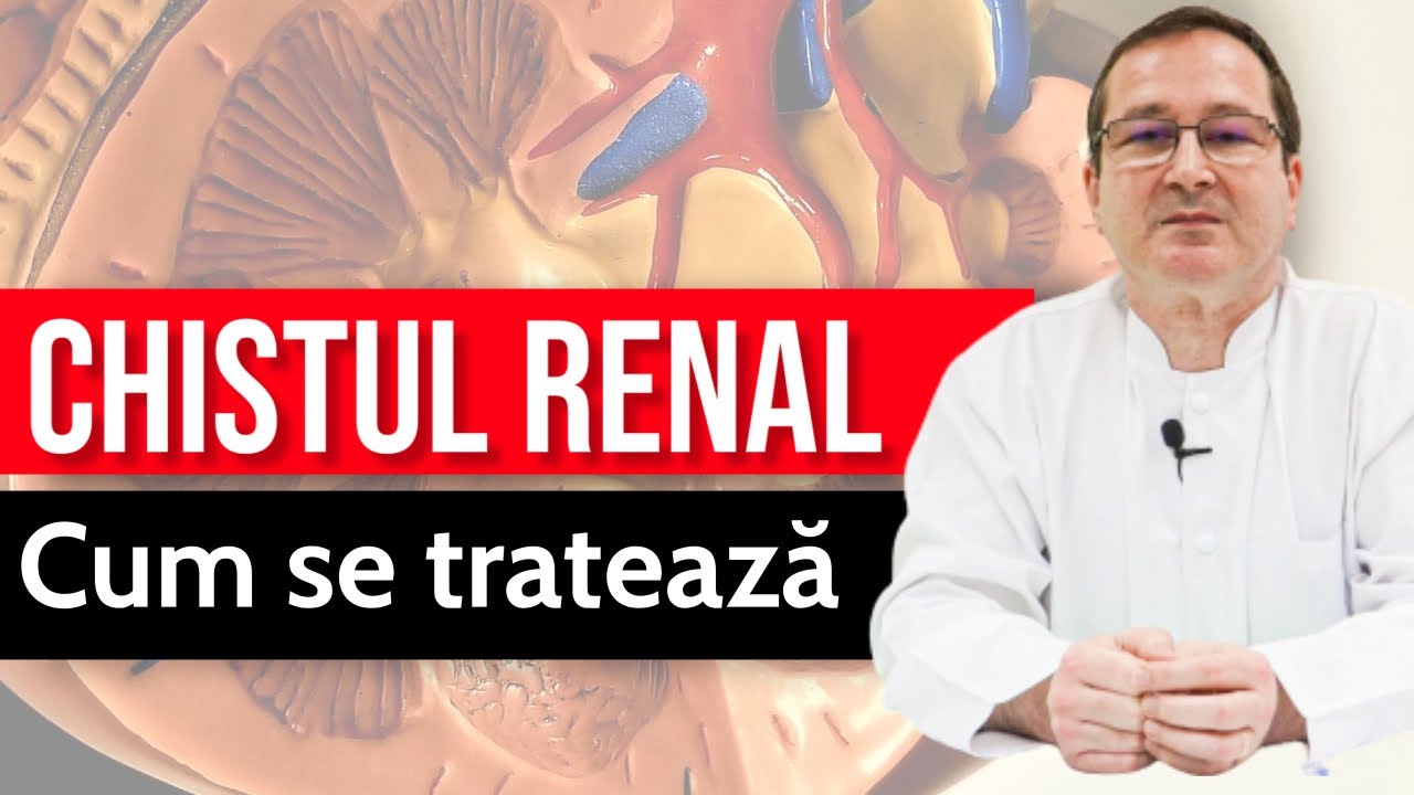CHISTUL RENAL. De ce apare și cum se tratează - YouTube