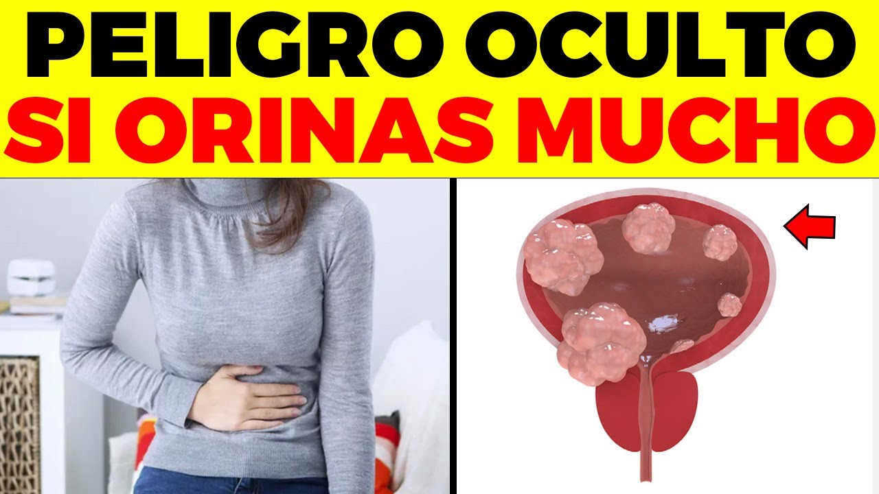 MICCION EXCESIVA! Por Esta Posible Peligrosa Razón ORINAS MUCHO Y Nadie ...