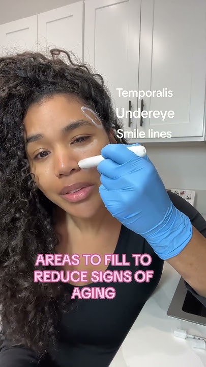 Areas To Fill To Reduce Signs Of Aging Youtube