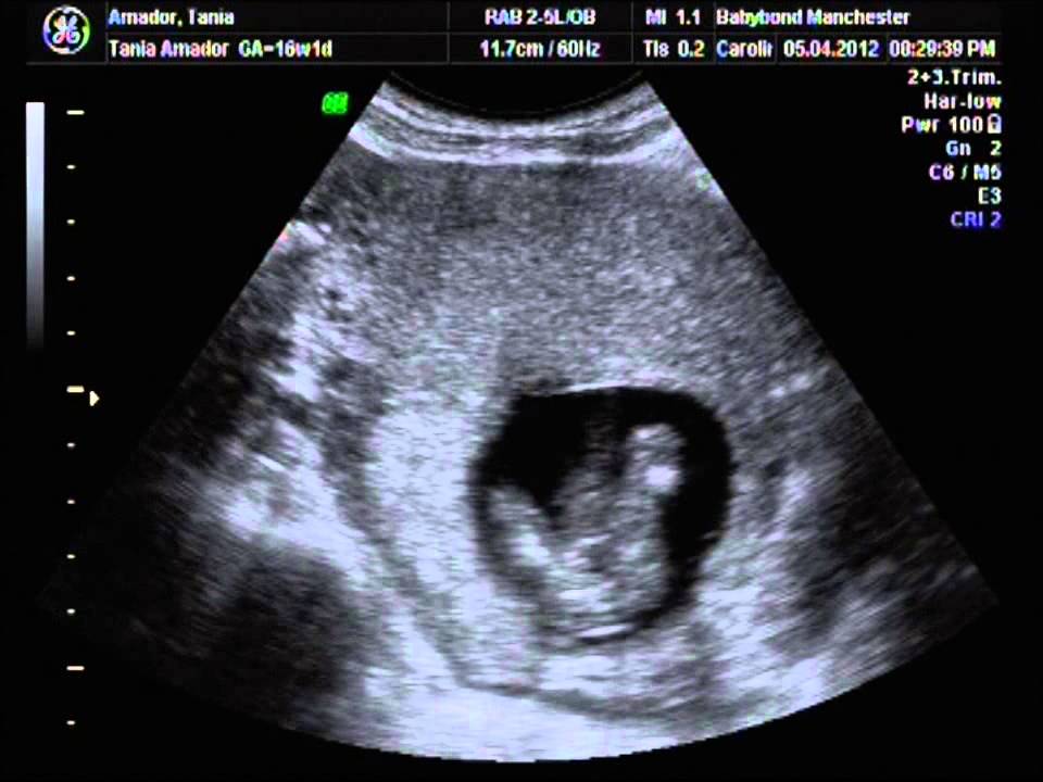 16 weeks pregnant gender scan BOY - YouTube