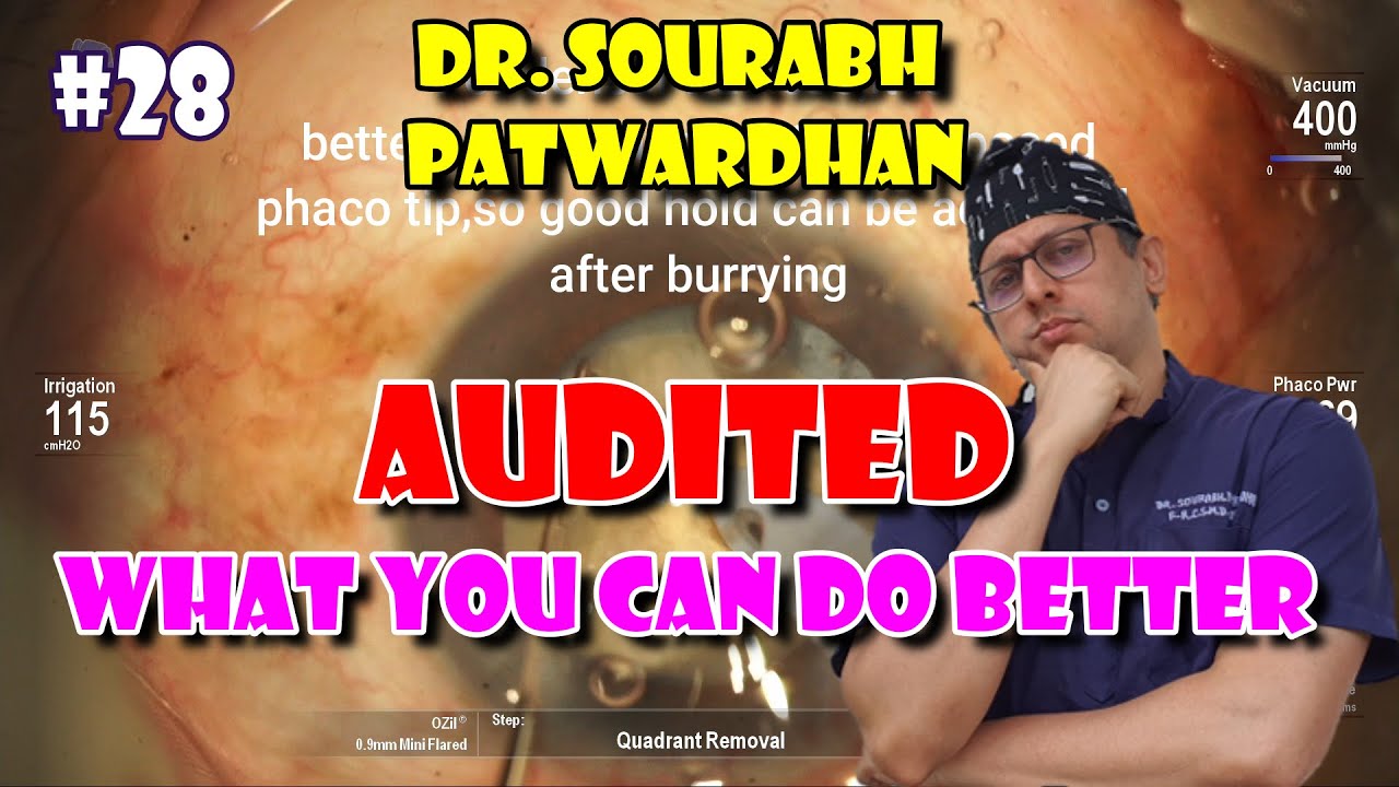 Commented 28 Audited Surgical Video: What you can do better Dr Sourabh ...