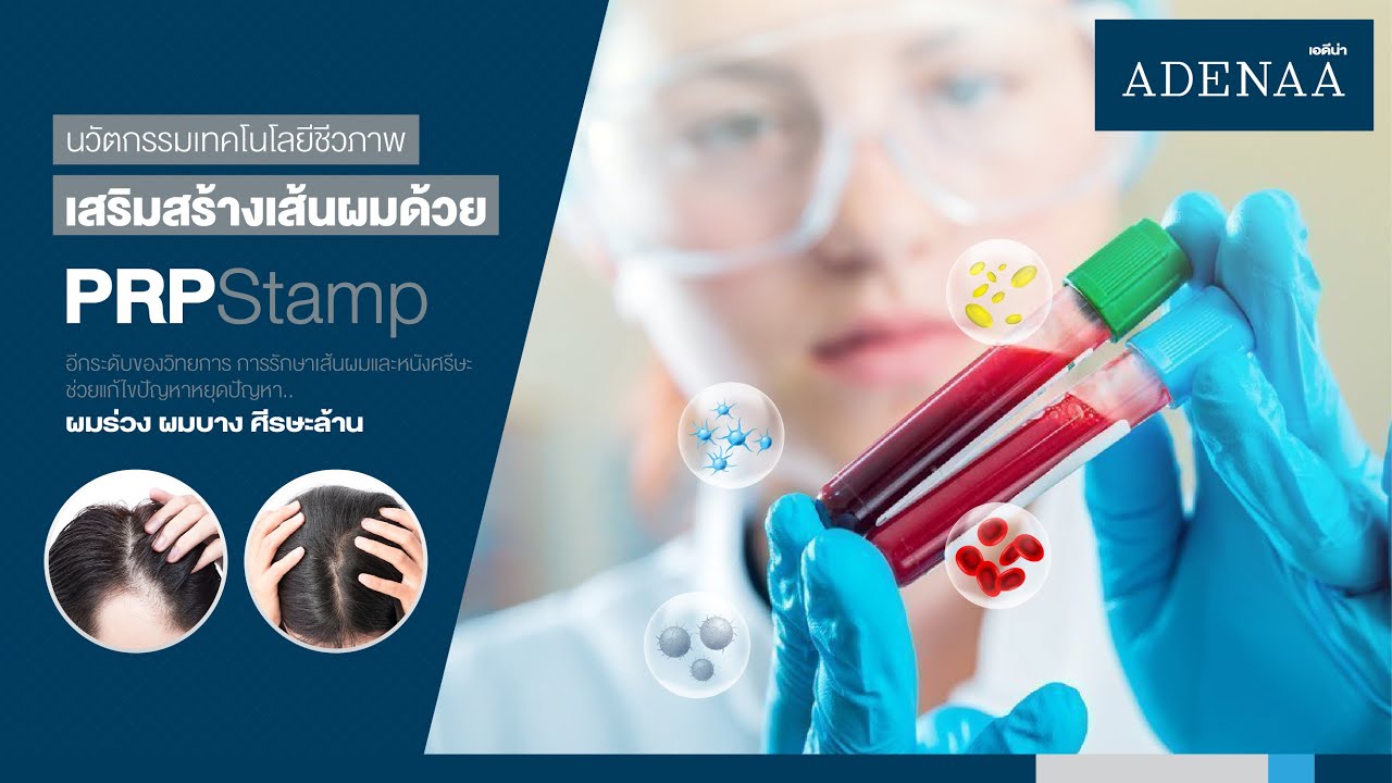PRP Stamp จากเอดีน่า หยุดปัญหา ผมร่วง ผมบาง ศีรษะล้านโดยไม่ต้องผ่าตัด ...
