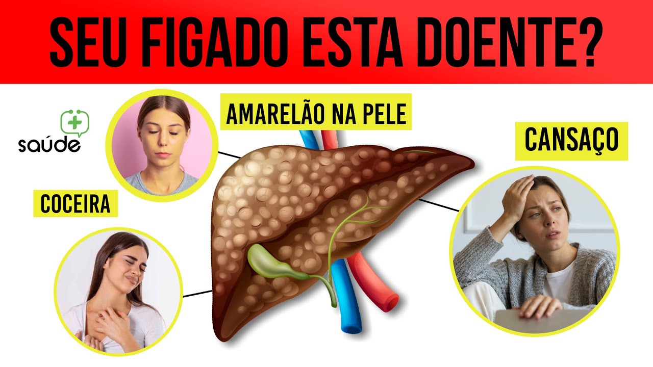 12 SINTOMAS ESTRANHOS DE PROBLEMAS NO FÍGADO - YouTube