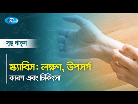 স্ক্যাবিস : লক্ষণ, উপসর্গ, কারণ এবং চিকিৎসা | Sustho Thakun | Rtv Health Program