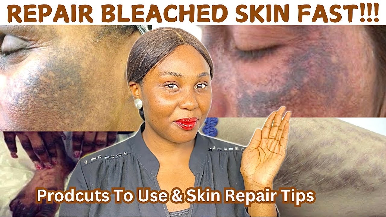 How To Repair Bleached / Damaged Skin For A Healthy Glow - YouTube