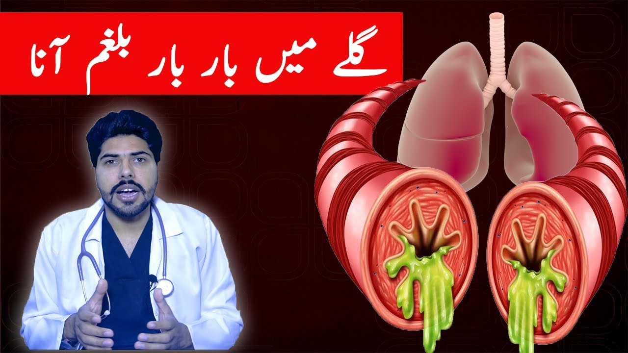 Top 3 Causes of Constant Mucus (Phlegm) in Throat Lecture 17 - YouTube