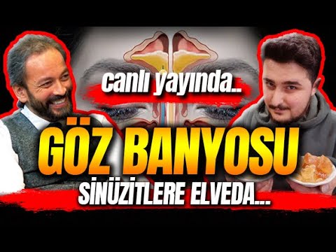SİNÜZİTLERE ELVEDA Canlı YAYINDA GÖZ BANYOSU - FUAT SAPANCI I MURAT ZURNACI