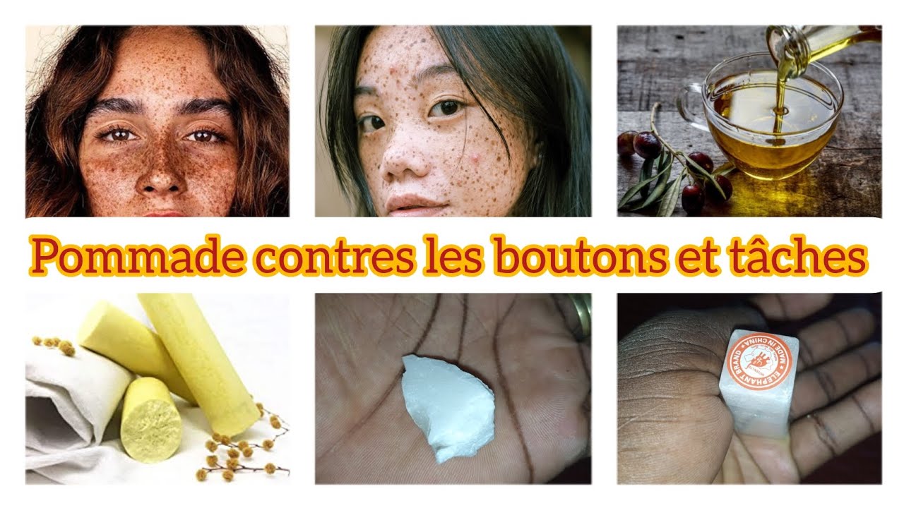 Pommade contre boutons et tâches acnés bref infection cutanée de toute ...