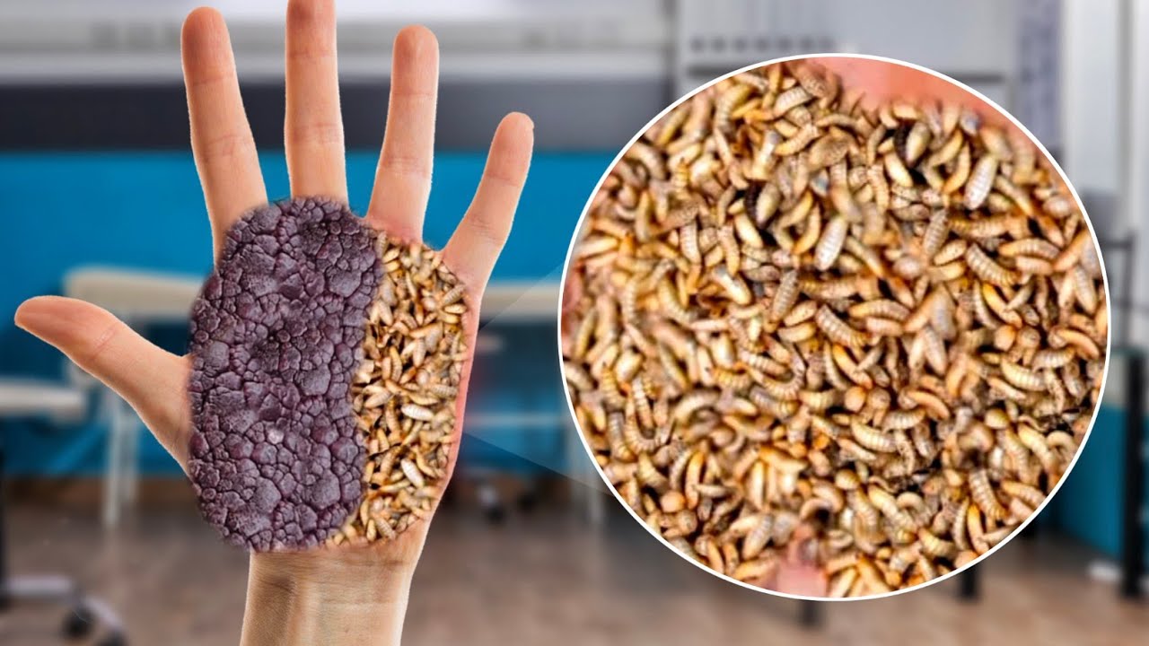 ASMR Remove Worm & Maggot Hand Infected | Severely Injured Animation ...