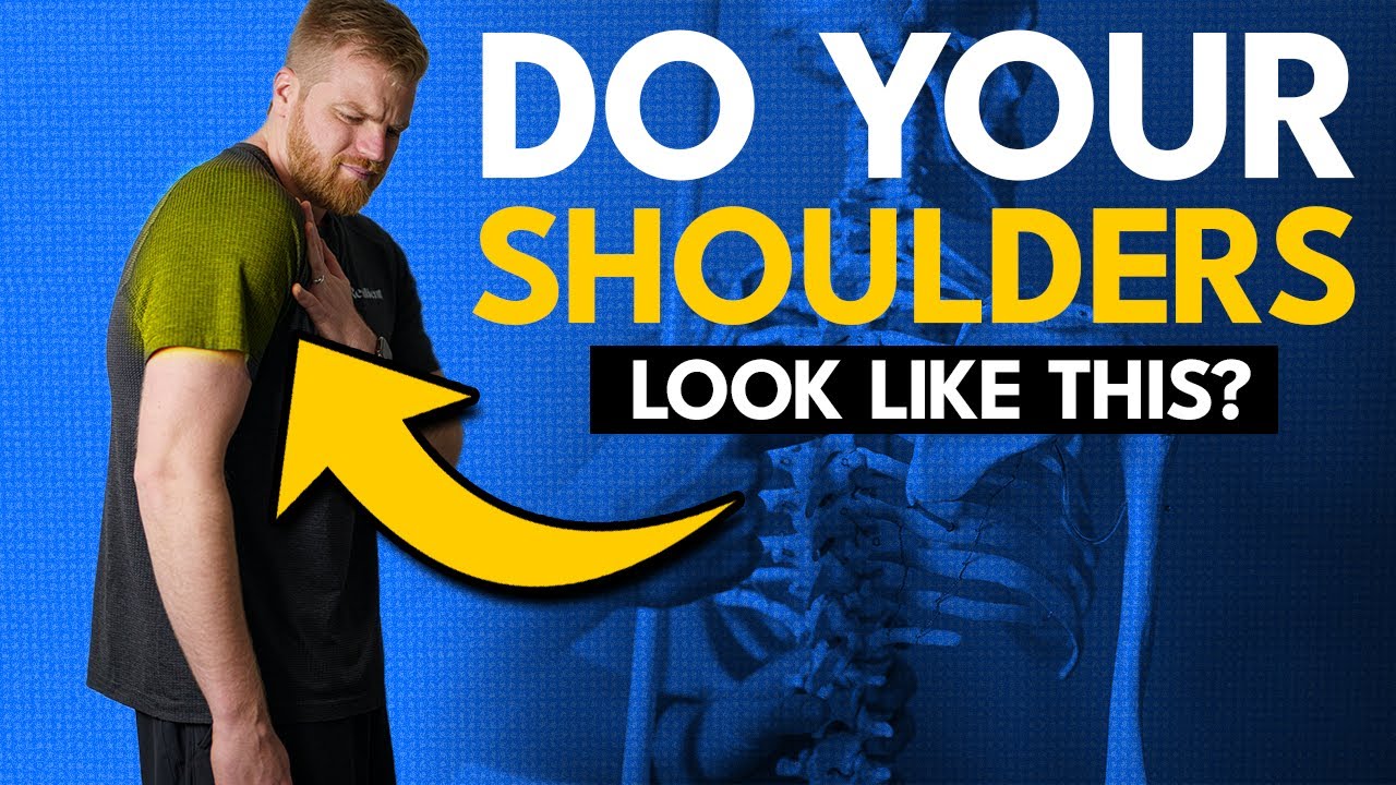 How to FIX Rounded Shoulders Fast: The Ultimate Posture Solution - YouTube