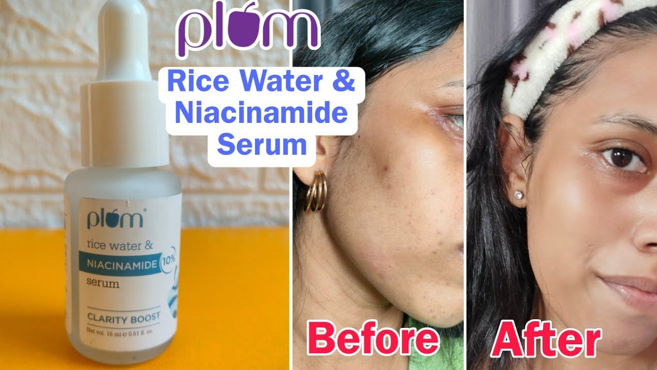 Plum💙Rice Water & Niacinamide Serum Review💙Non-sponsored | Best Serum ...
