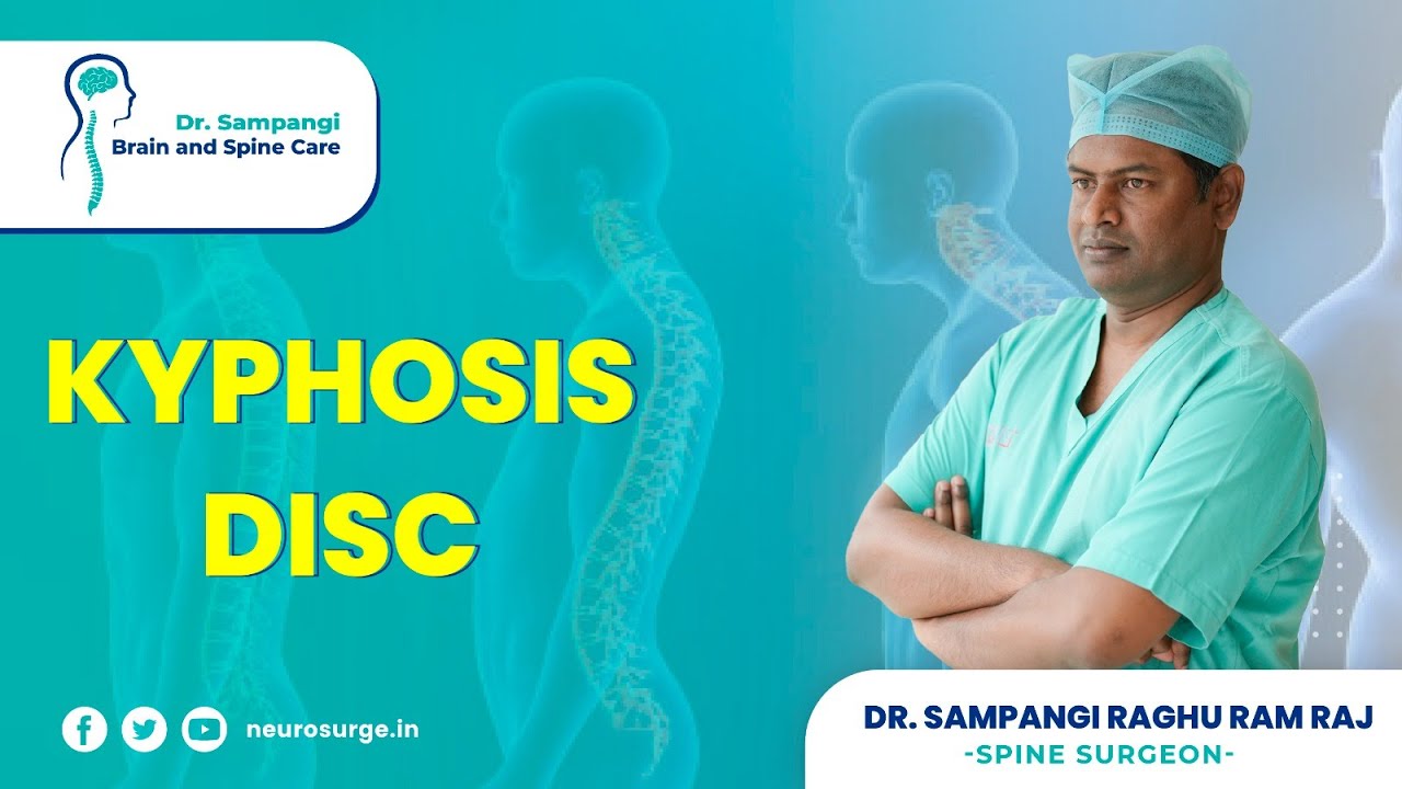 Understanding Kyphosis | Comprehensive Guide on Causes, Symptoms ...