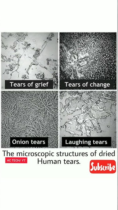 Microscopic structures of dried Human tears 😱 #science #scienceshorts # ...