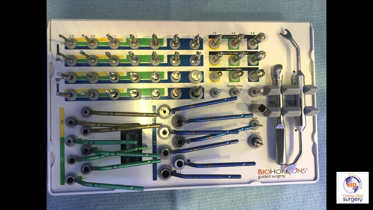 Stretching the Envelope- Made Possible by Guided Implant Surgery (HD ...