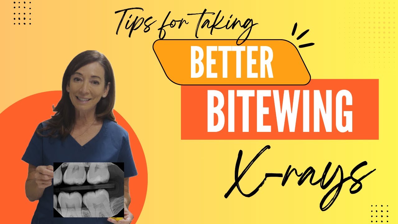 Three secrets to taking Better Bitewing X-rays - YouTube