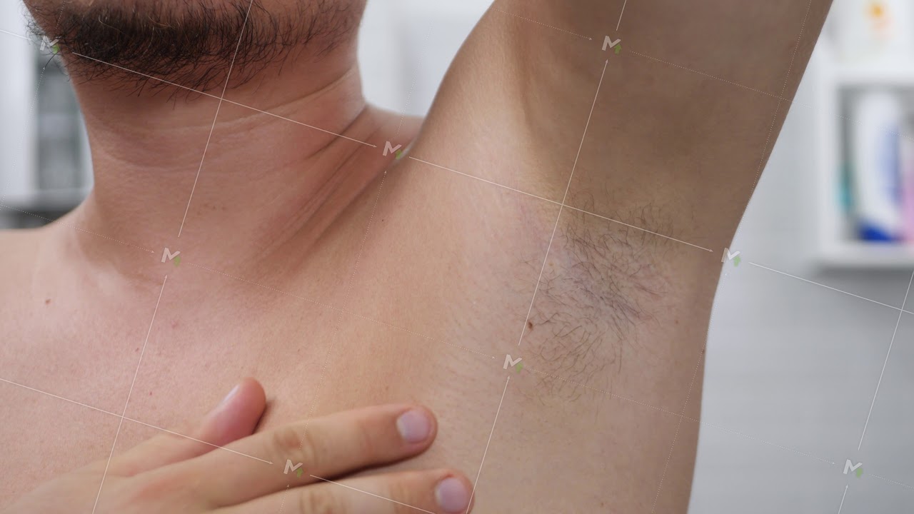 Natural underarm contains many sweat glands and axillary hair - YouTube