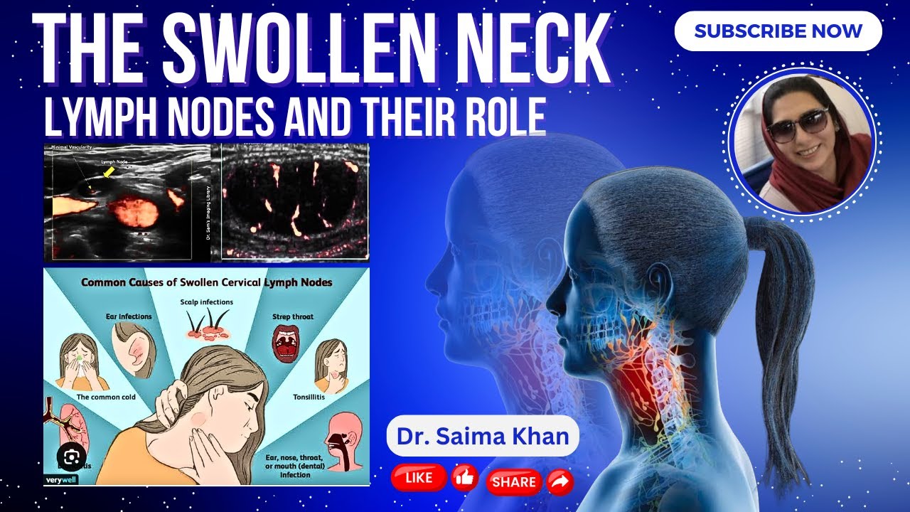 Understanding the Swollen Neck: Lymph Nodes and Their Role #ultrasound ...