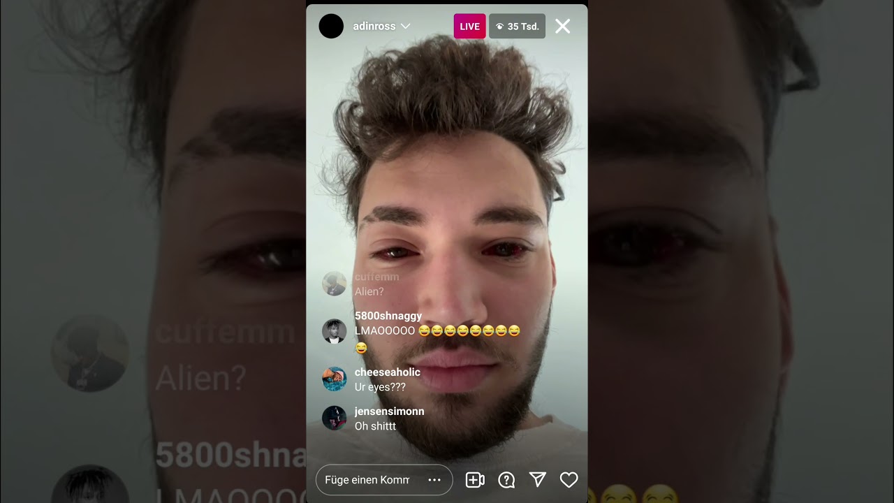 Adin Ross has Bloody Eyes 😨🧛‍♂️ IG Live Short(10/16/21) #short - YouTube