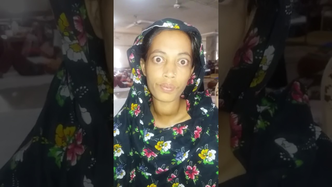 Exophthalmos, Lid retraction, Lid lag, Diffuse goitre in Graves ...