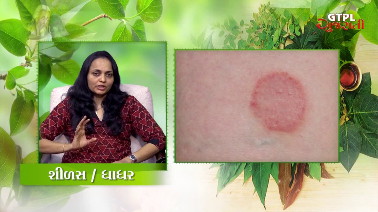Shidas and Dhadhar Treatment by Dr. Renuka Siddhapura - Ayunature Care ...