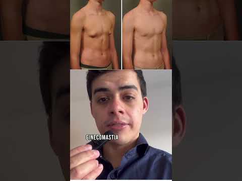 Sabia isso? #therock #celebridades #cirurgiaplastica #ginecomastia #mamas