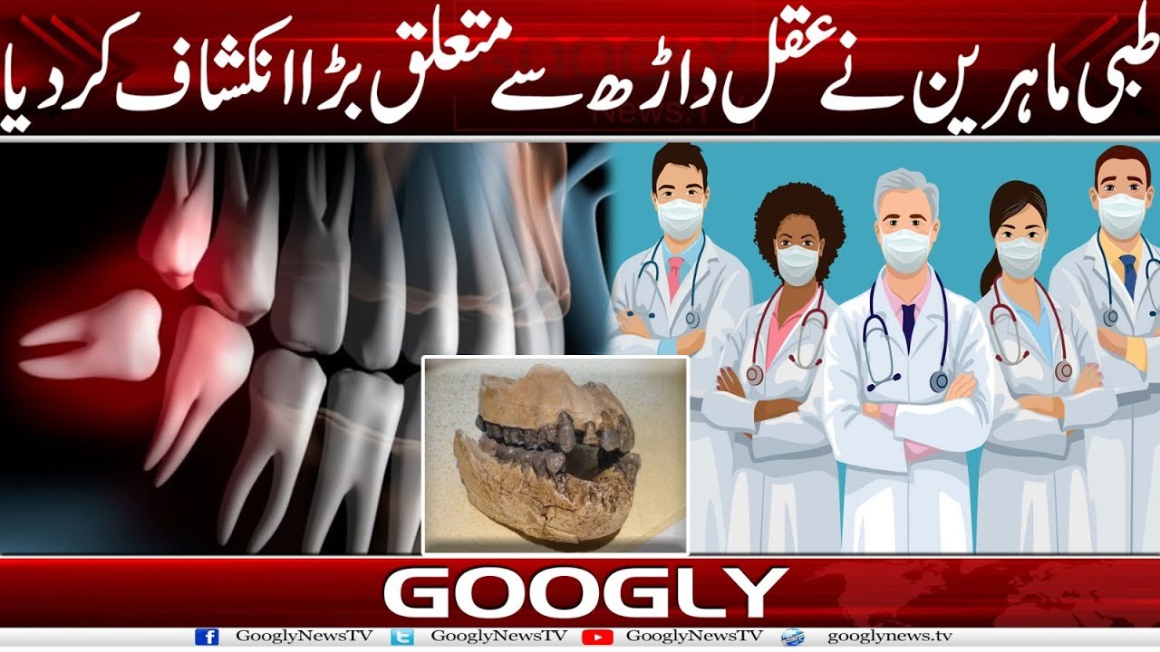 Tibbi Mahreen Nai Aqal-Darh Sai Mutaliq Barra Inkishaf Kar Dya | Googly ...